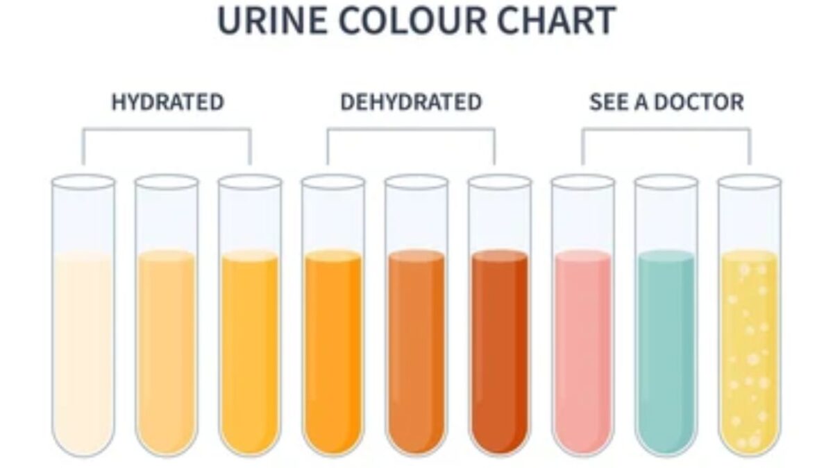 the color of urine tells the state of health know what the color Urine ...